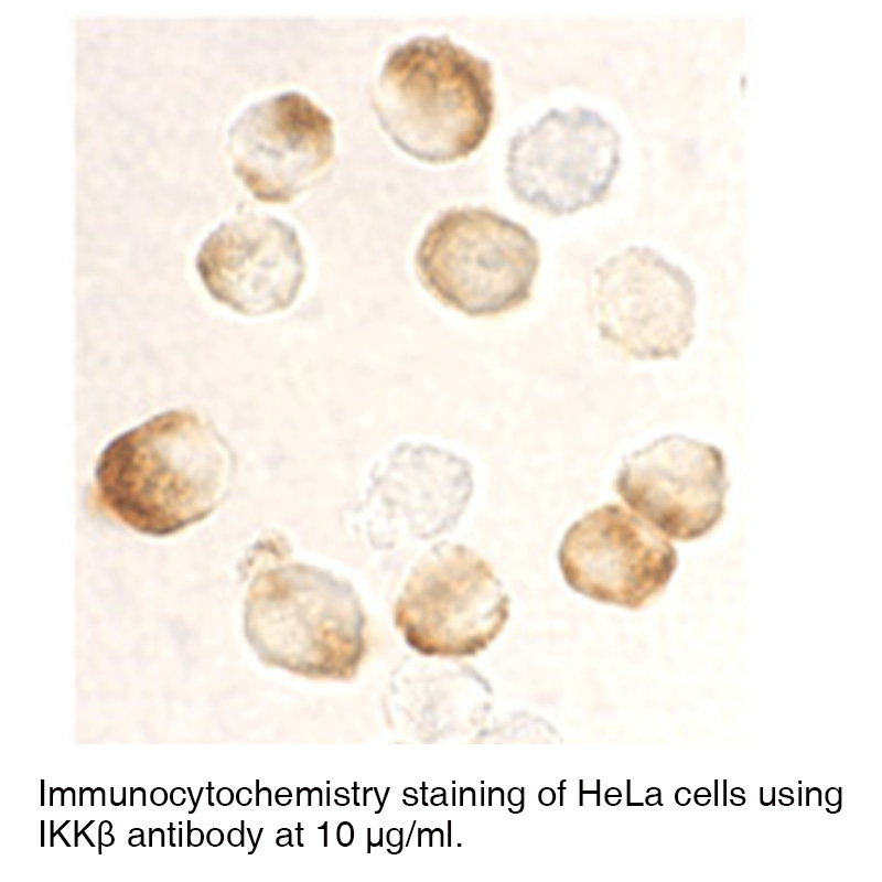 Anti-Human IKappaBKinase Beta (CT3) (IKKβ) | Leinco