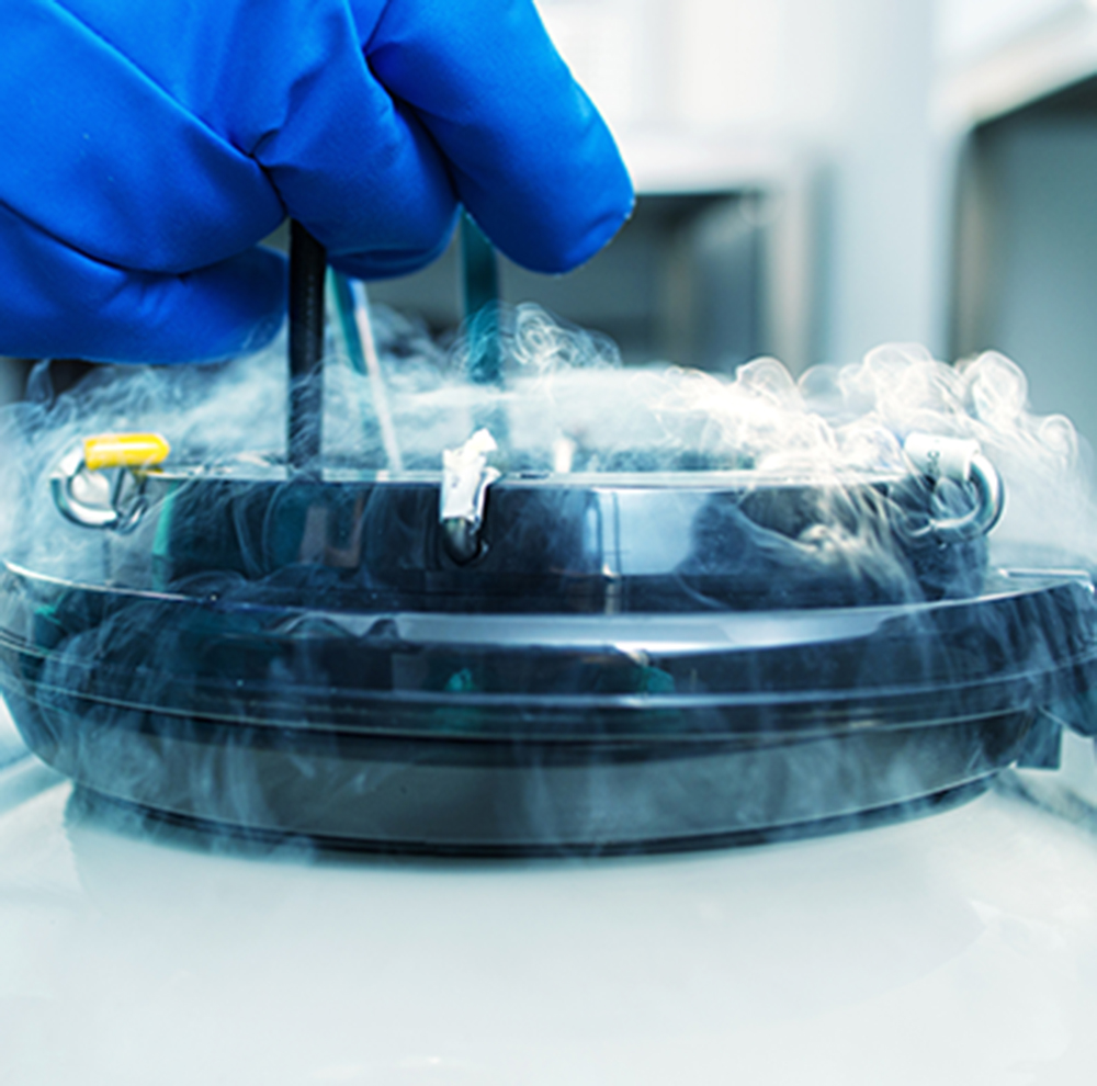 Cell Line Storage & Cell Banking Service | Leinco Technologies