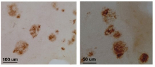 Anti-CLAC-P Antibody (28115) - Leinco Technologies