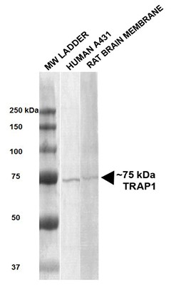 Anti-TRAP1/Hsp75 Antibody (11143) - Leinco Technologies